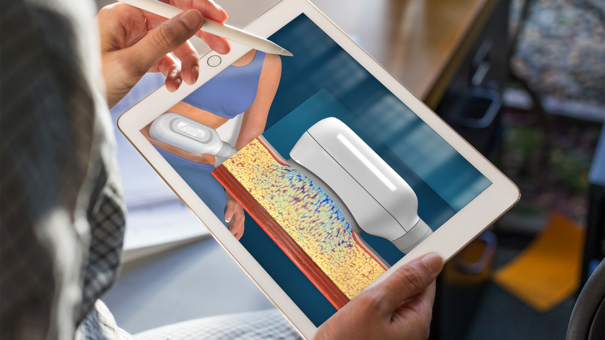 All-new CoolSculpting animation now available in the Plastic Surgery L ...