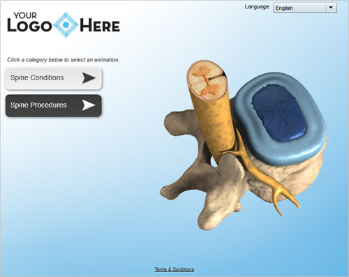 Understand.com® Releases Spine Animation Library to Educate Patients o