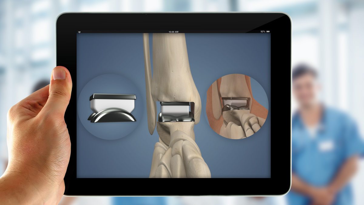 Understand.com® expands Orthopaedic Library with the release of the br