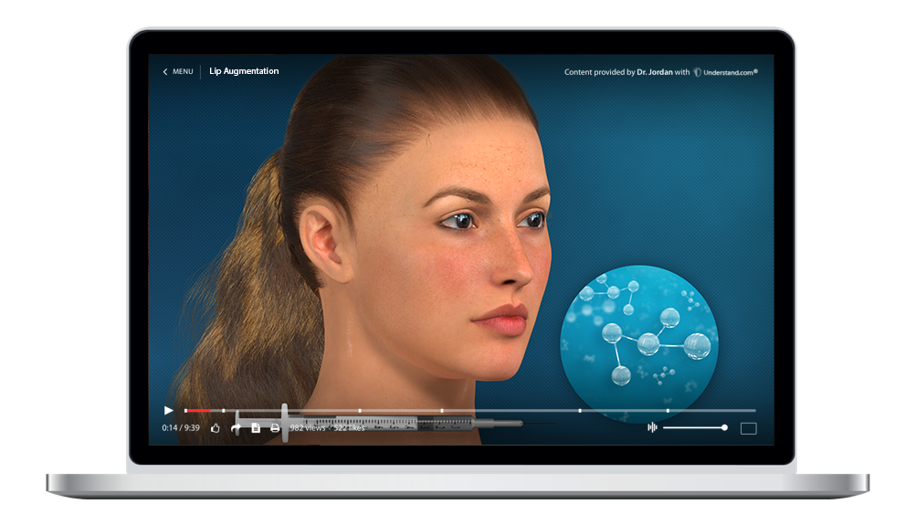 Lip Augmentation Animation – Understand.com