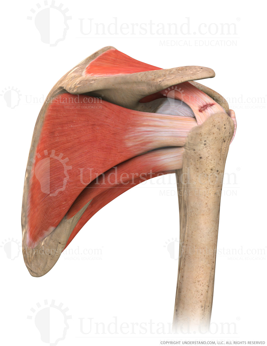 Partially Torn Rotator Cuff Posterior Three Quarter Image – Understand.com