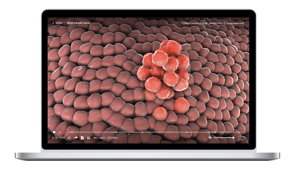 What Is Breast Cancer Animation – Understand.com