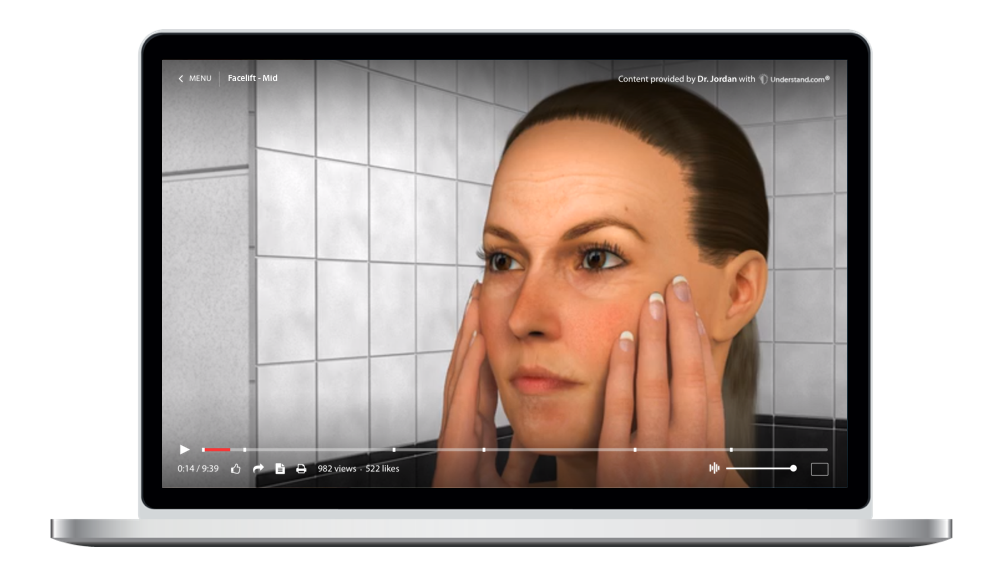 Facelift - Mid Animation – Understand.com