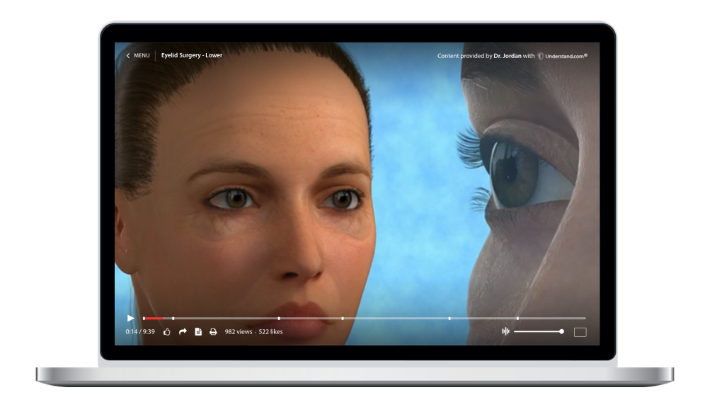 Eyelid Surgery - Lower Animation – Understand.com