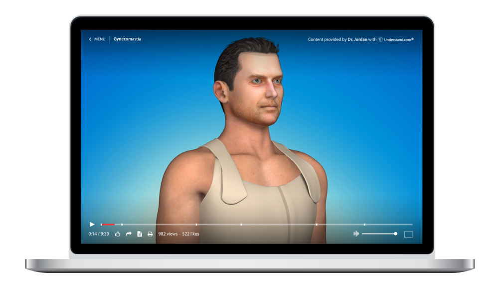 Gynecomastia Surgery Animation – Understand.com