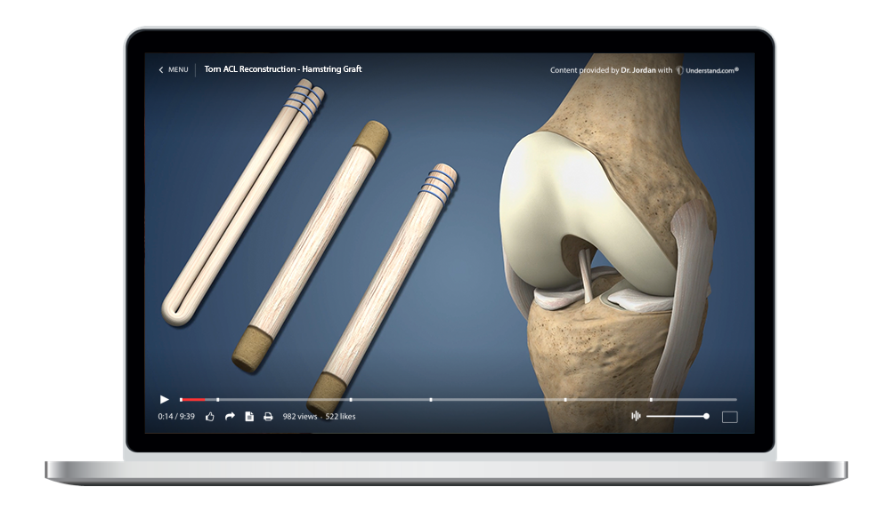 hamstring used for acl reconstruction