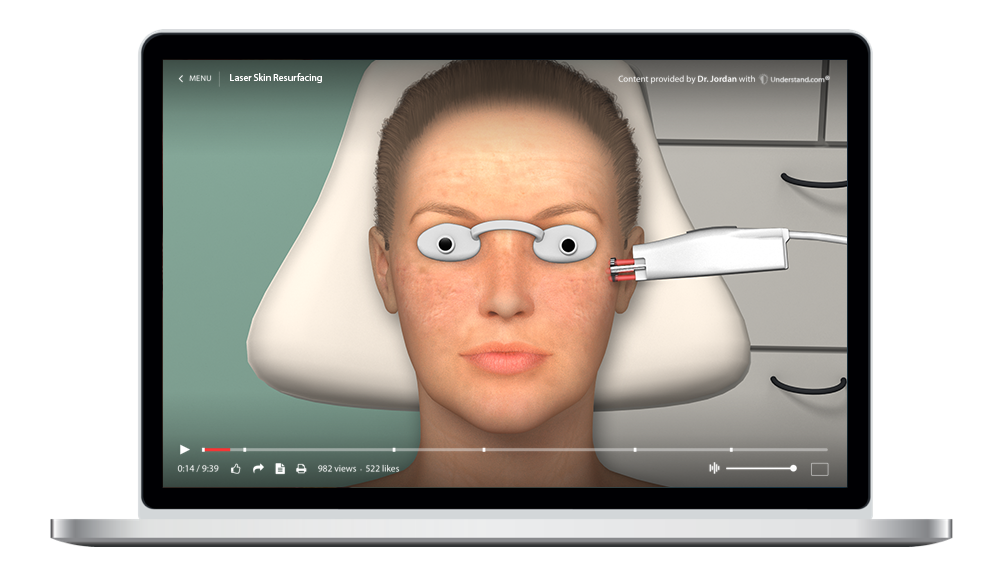 Laser Skin Rejuvenation Animation – Understand.com