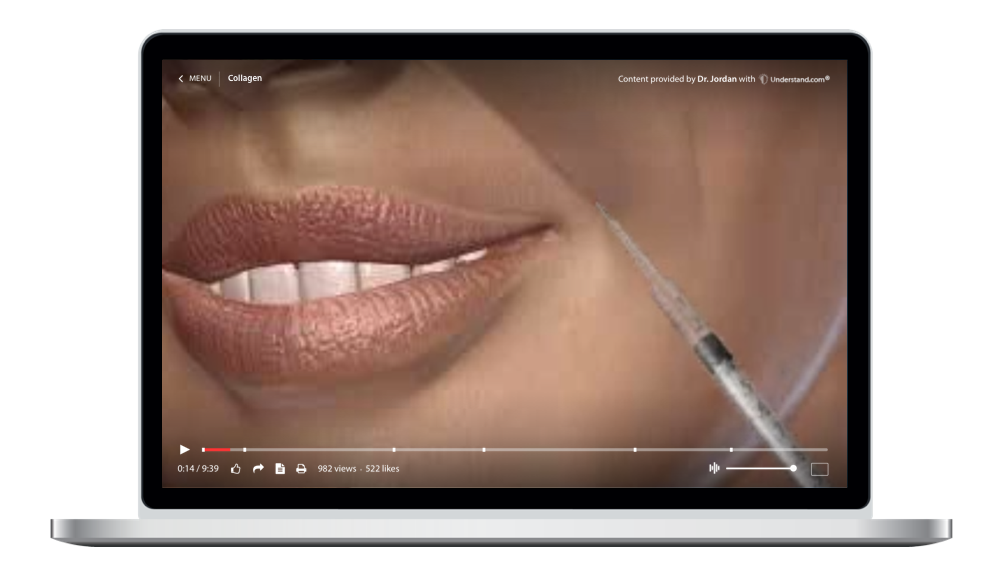 Collagen Animation – Understand.com