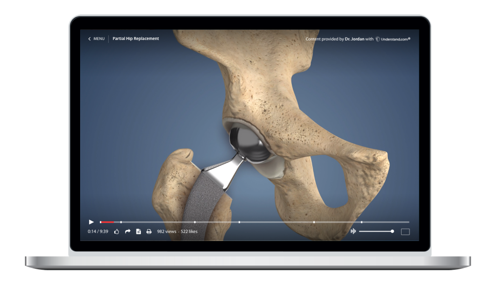 Partial Hip Replacement