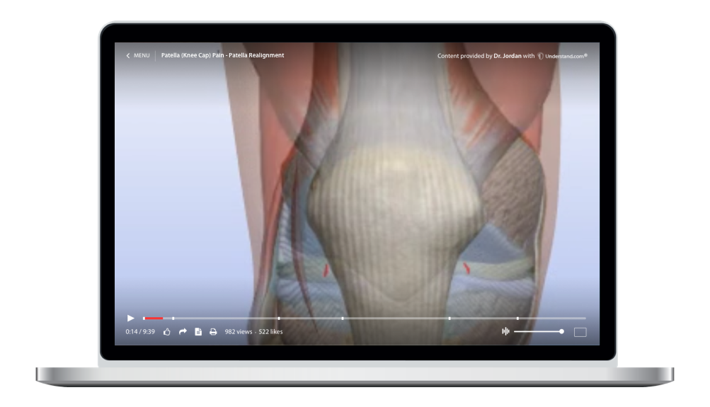 Patella (Knee Cap) Pain - Patella Realignment Animation – Understand.com